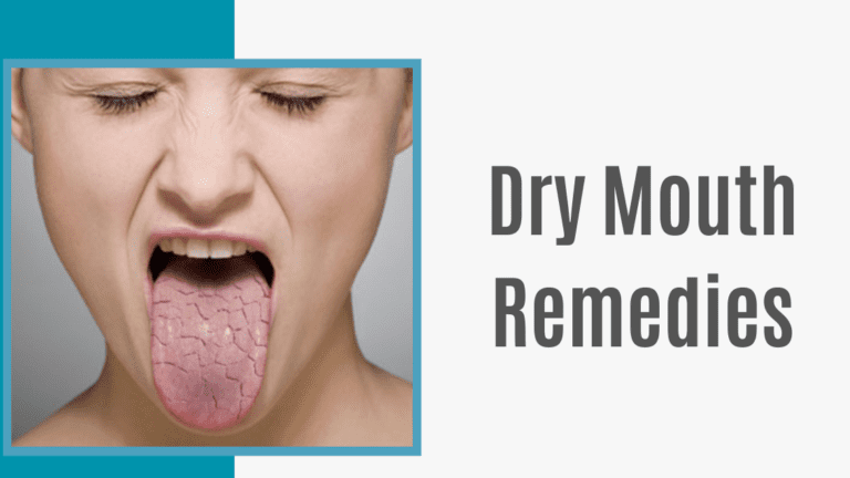 Dry Mouth: What Causes It and How to Treat It - thedentalgroup.com